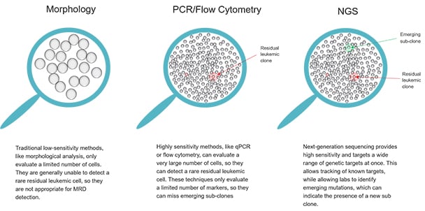 Measurable Residual Disease (MRD) in Acute Myeloid Leukemia (AML)